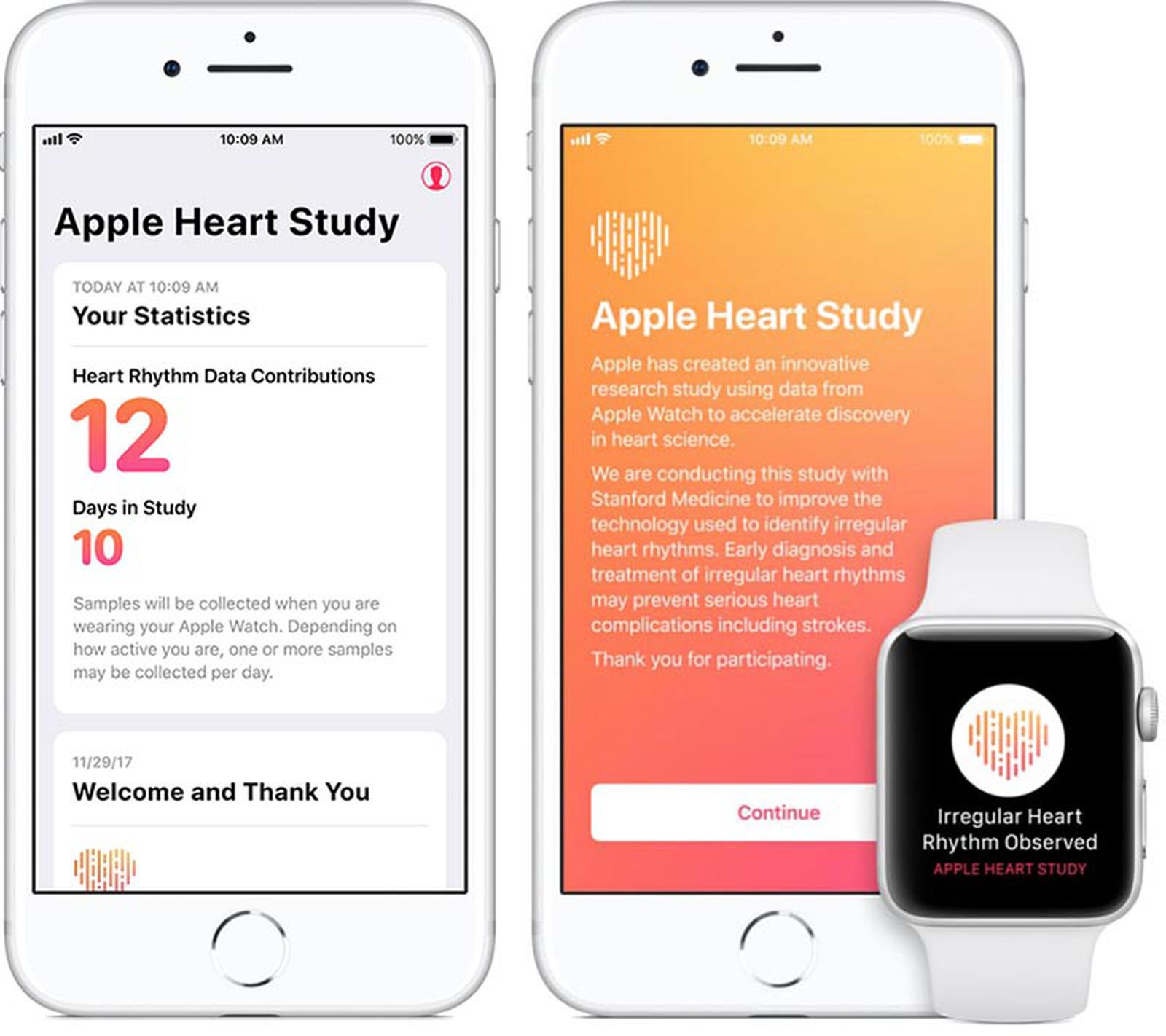 Apple Watch Owners Can Participate in Apple Heart Study to Identify Irregular Heart Rhythms ...