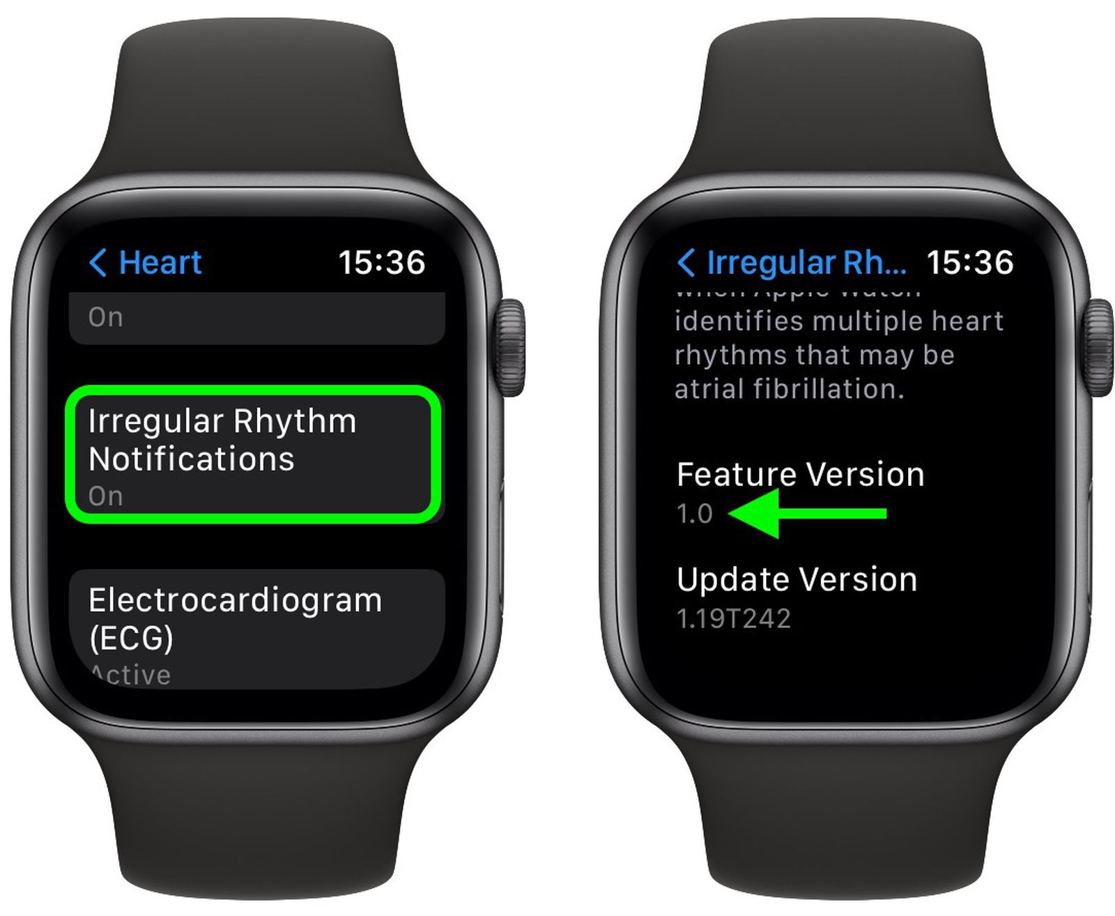 How to Check Which Version of the Irregular Rhythm Notification feature Your Apple Watch is ...
