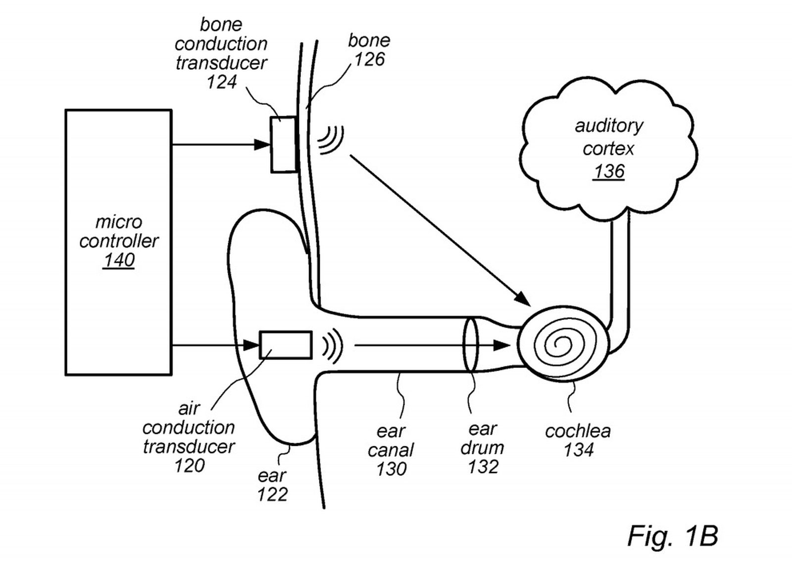 Apple Bone Conduction Hybrid System Solves Drawbacks, Reveals Patent ...